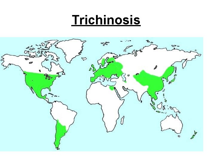 TISSUE NEMATODES COMMON TISSUE NEMATODE INFECTIONS Trichinella spiralis