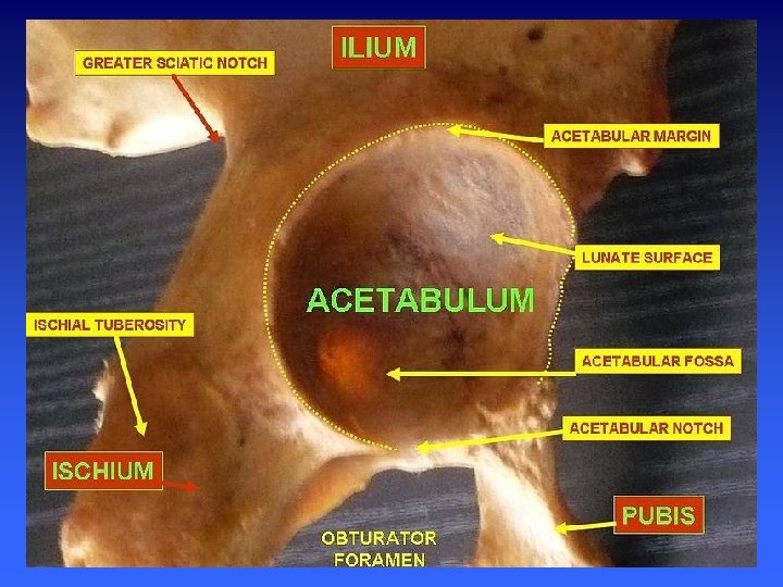 BIOMECHANICS OF HIP JOINT Prepared by Dr Hazrat