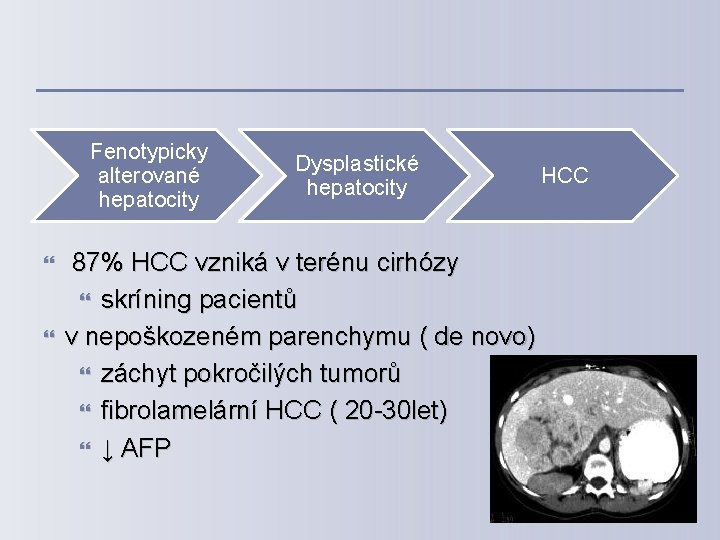 Jak poznat HCC a jak se vyvarovat chyb