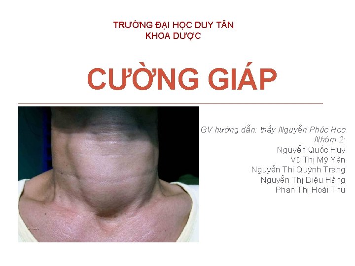 TRNG I HC DUY T N KHOA DC