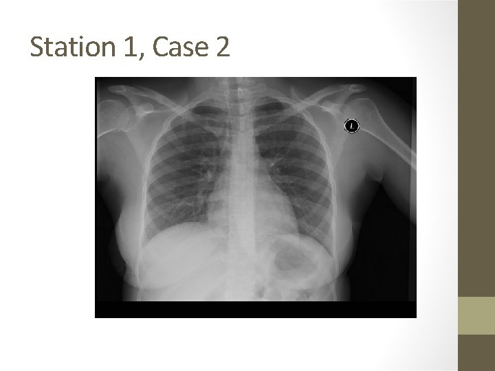 Intro To Radiology Authors Drs Sandhya S Brachio