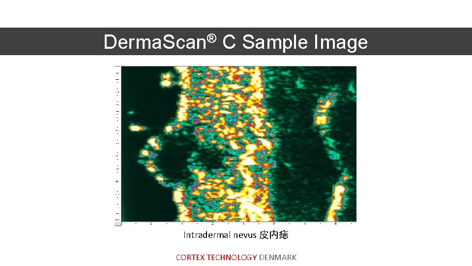CORTEX TECHNOLOGY DERMASCAN C High Resolution Ultrasound visualizing