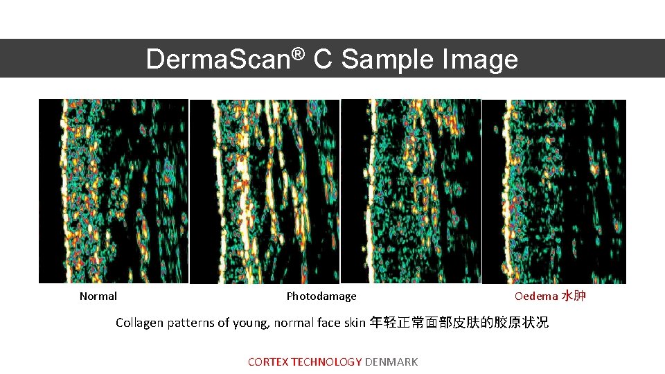 CORTEX TECHNOLOGY DERMASCAN C High Resolution Ultrasound visualizing