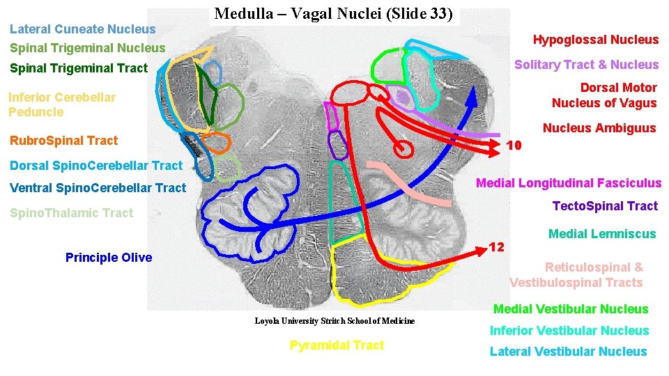 Neuroanatomy Brainstem Slides Self Assessment Use as a