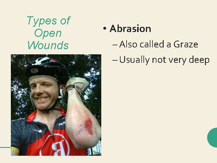 SOFT TISSUE INJURIES INTRODUCTION Have you ever suffered