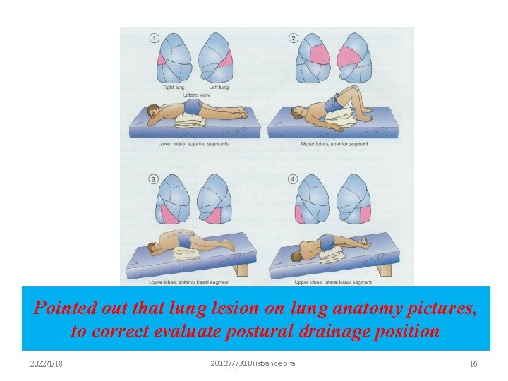 The Effects of Respiratory Rehabilitation Program on SixMinute