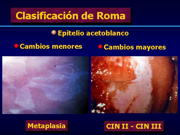 Papel de la colposcopia en la patologa cervical