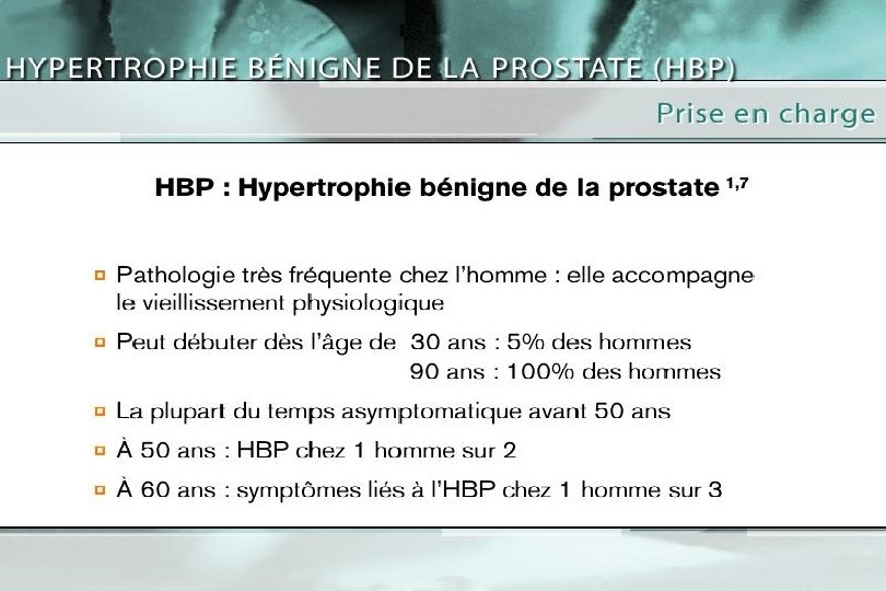 Hypertrophie Bnigne de la Prostate La prostate Est