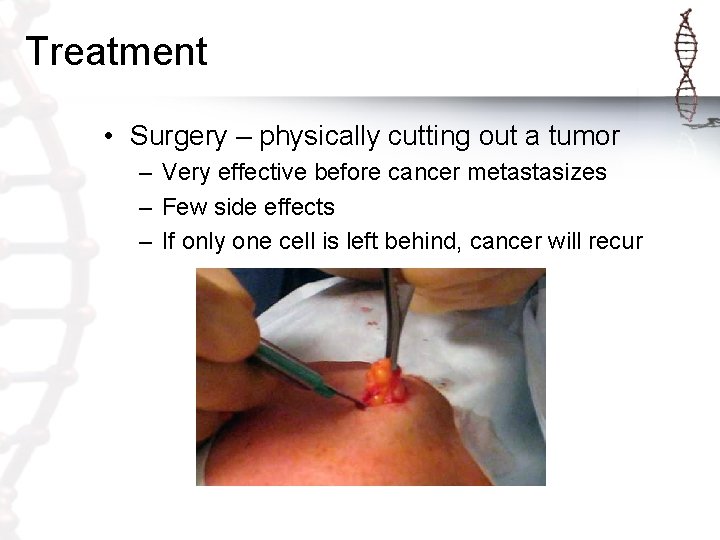 Cancer Basics EQ What does cancer have to