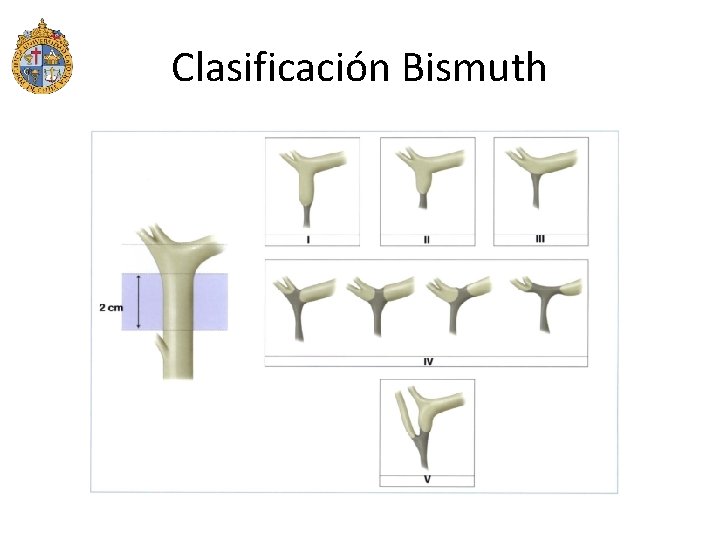 Iatrogenic Biliary Injuries Identification Classification and Managment ...