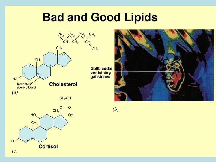 Lipids Lipids are composed of Carbon Hydrogen Oxygen