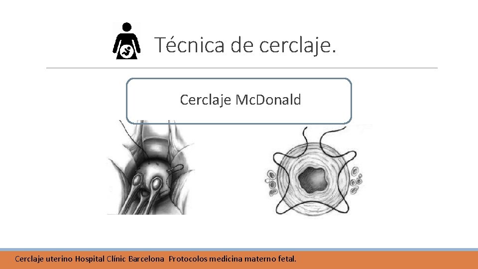 Insuficiencia stmico cervical MARIANA LUISA RUIZ GONZALEZ RESIDENTE
