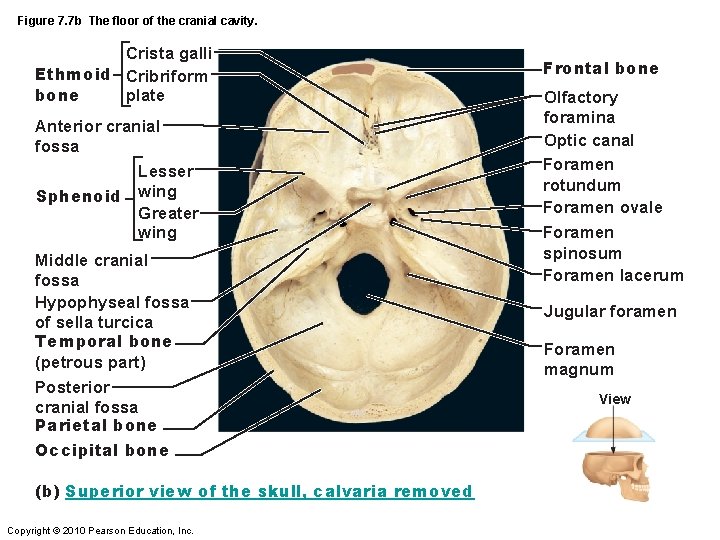 The Axial Skeleton The Skull This structure is