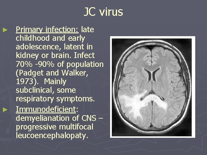 Viral opportunistic infections Joanna NikitorowiczBuniak Immunology ...