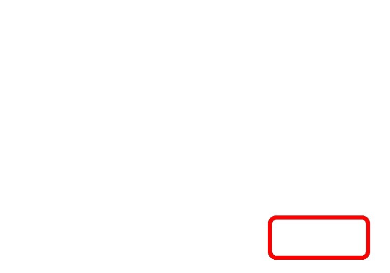 Caso clnico indicao de septostomia Frederico Thadeu A