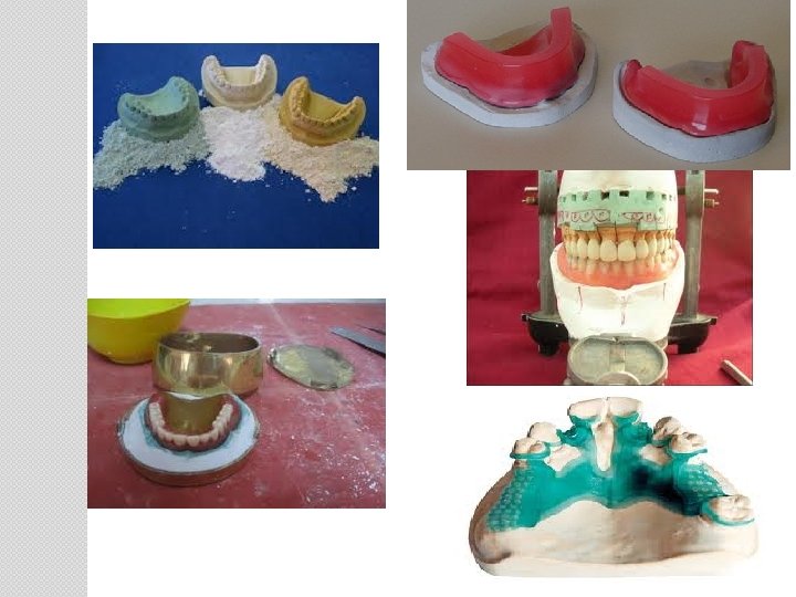 MODEL AND DIE MATERIAL Definition of model or