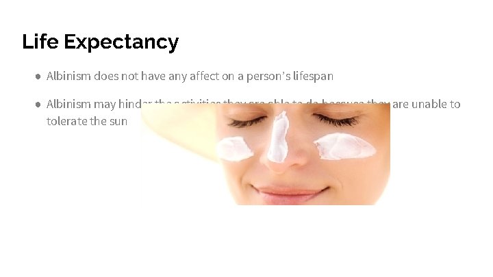 Albinism Thomas Campeau and Ashlyn Orr Disease Inheritance