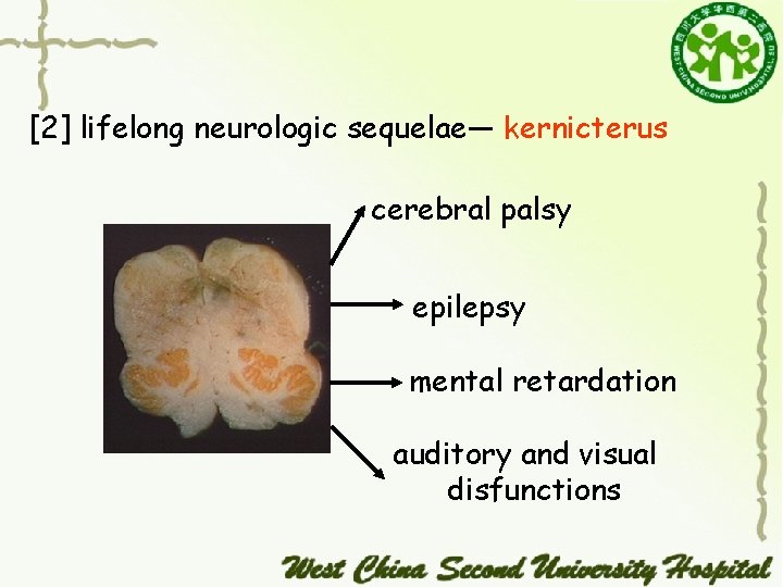 The Metabolic Characteristics of Bilirubin in Newborns Wu