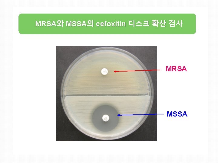 Methicillinresistant Staphylococcus aureus MRSA lactam methicillin S aureus