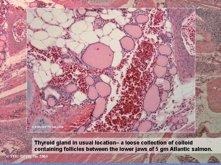 Thyroid gland in usual location a loose collection