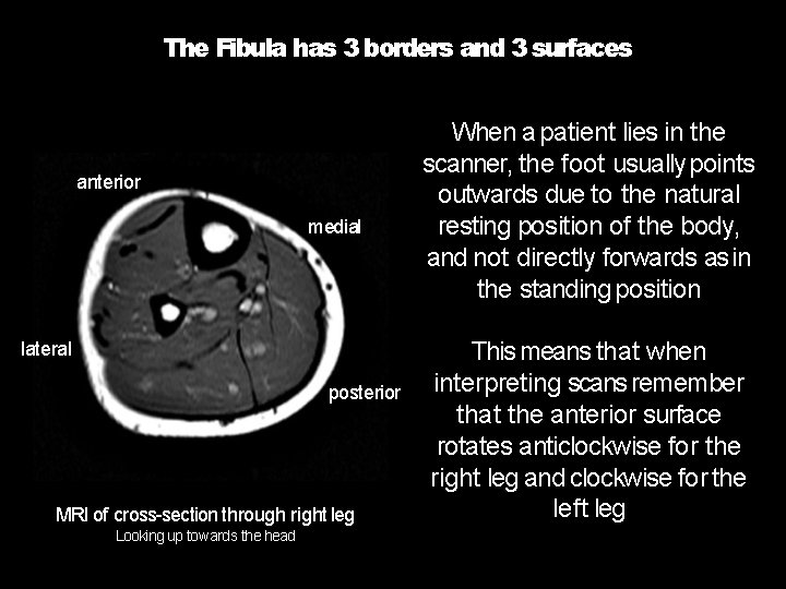 MBBS MC GROSS ANATOMY Prof Dr zubair Dr