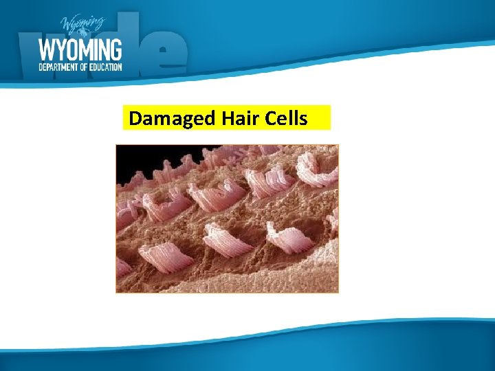Hearing Loss 101 Billie Wortham Wyoming Department of