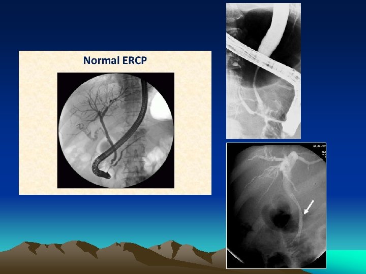 Diagnostic endoscopy Mark Mc Alindon Gastroenterology The gastrointestinal