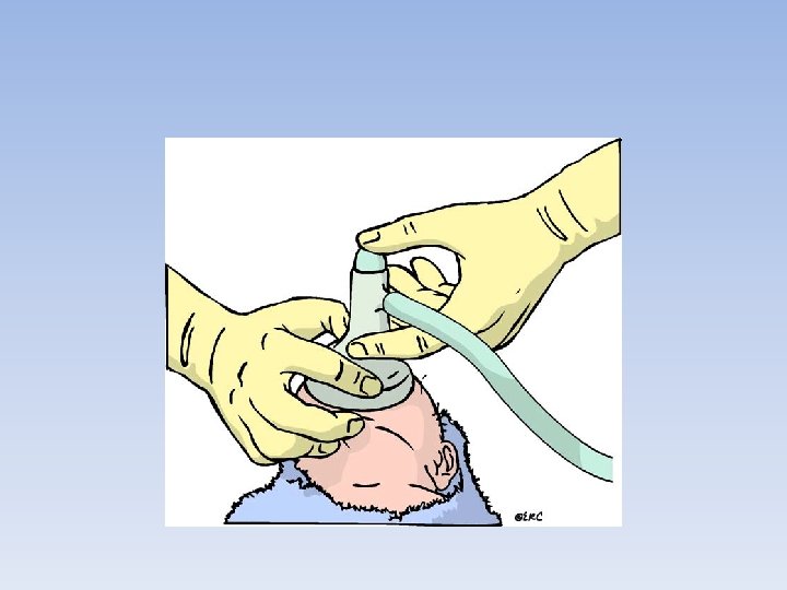 PBLS PALS NLS According to European Resuscitation Council