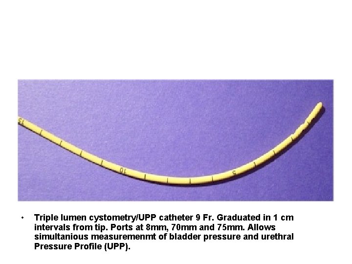Sagging and weakness of the bladder neck Funneling
