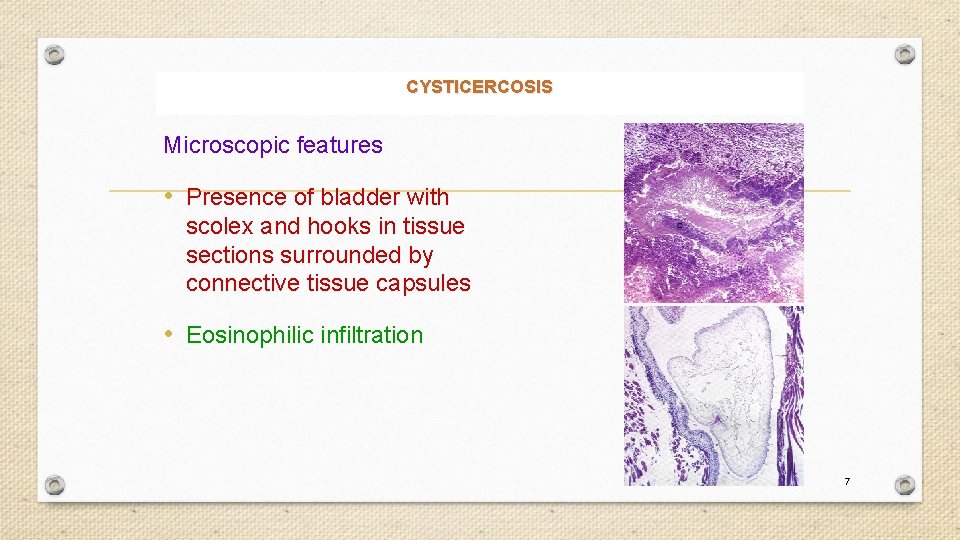 CYSTICERCOSIS CYSTICERCOSIS Cysticercosis is a parasitic disease of