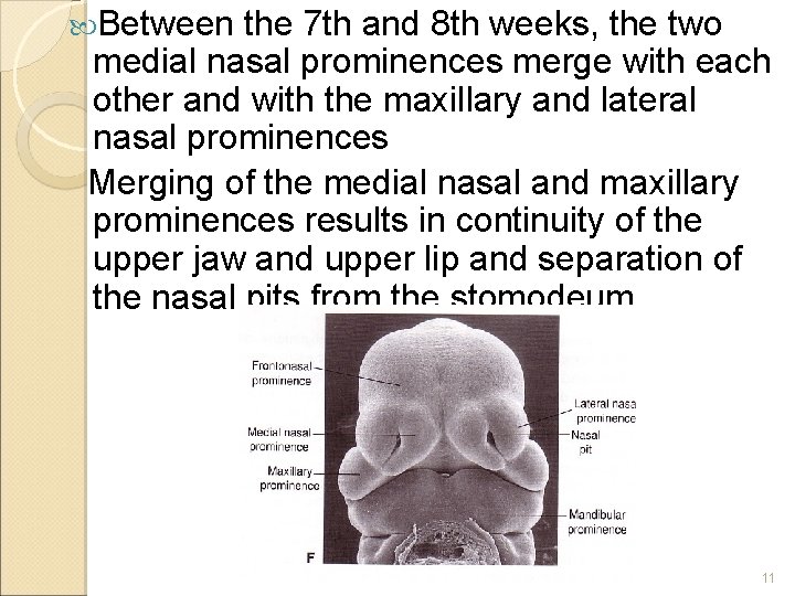 DEVELOPMENT OF FACE NOSE AND PALATE By Prof