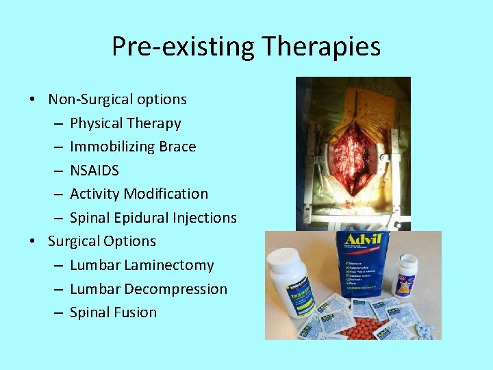 Limi Flex Spinal Stabilization System By Matthew Leon