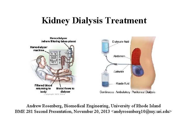 Kidney Dialysis Treatment Andrew Rosenberg Biomedical Engineering ...
