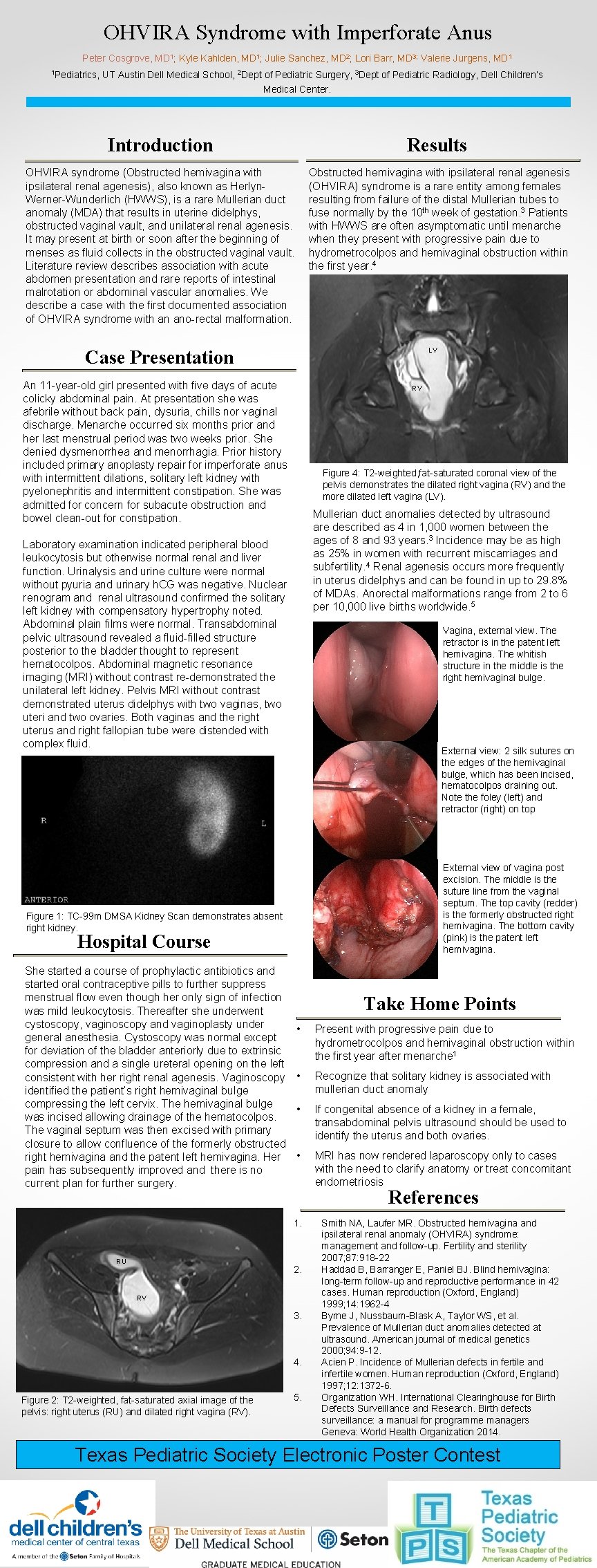 OHVIRA Syndrome with Imperforate Anus Peter Cosgrove MD