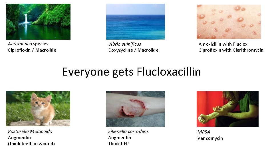 Soft Tissue Infections Adrian Boyle Overview Cellulitis Necrotising