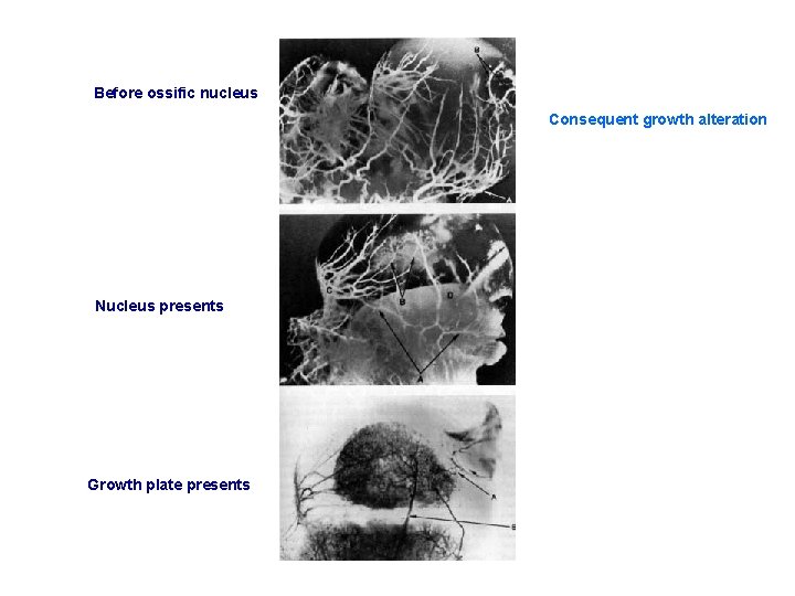 Bone Joint sepsis Septic Limp Joint swelling R