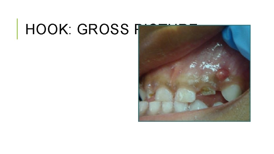 IMMUNE SYSTEM Jessica Baldwin Amber Minutillo Lydia Acha