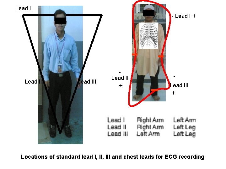 PRACTICAL 2 ELECTROCARDIOGRAM ECGEKG By Mohamad Azmir bin