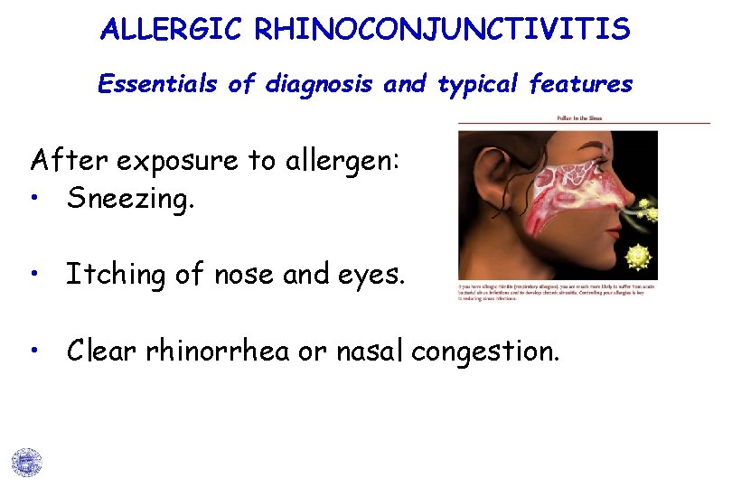 ALLERGIC RHINOCONJUNCTIVITIS Essentials of diagnosis and typical features