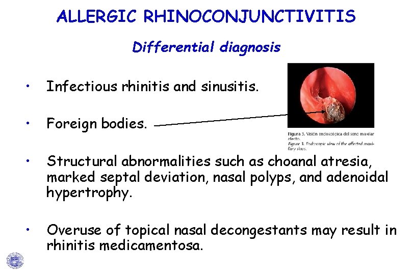 ALLERGIC RHINOCONJUNCTIVITIS Essentials of diagnosis and typical features