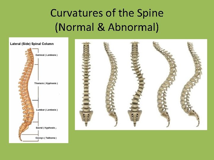 Lower Back Disorders Prevention By Nathan Winter MS