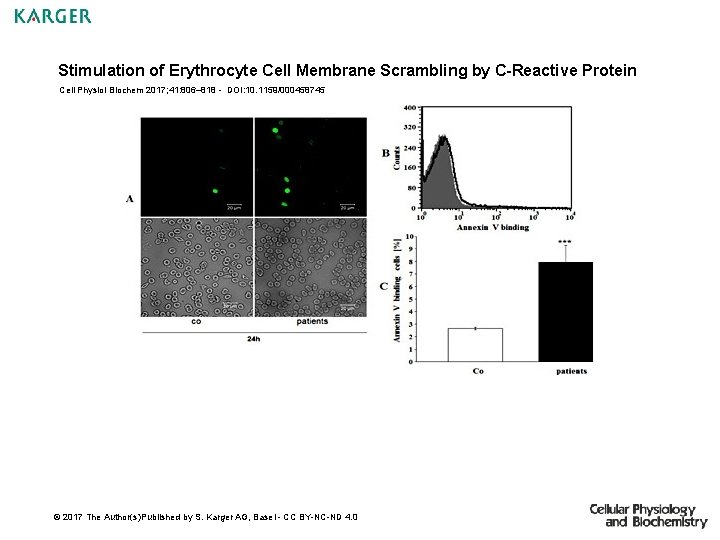 Stimulation of Erythrocyte Cell Membrane Scrambling by CReactive