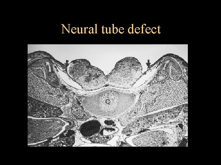 Pediatric Neurosurgery Baar Atalay M D Yeditepe University