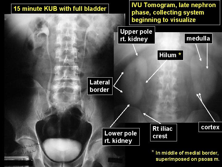 Unit 6 Radiography of the Excretory System RDSC