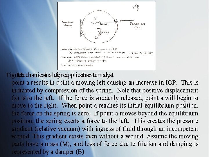Cataract Incision Fluid Ingress an Engineering Analysis David