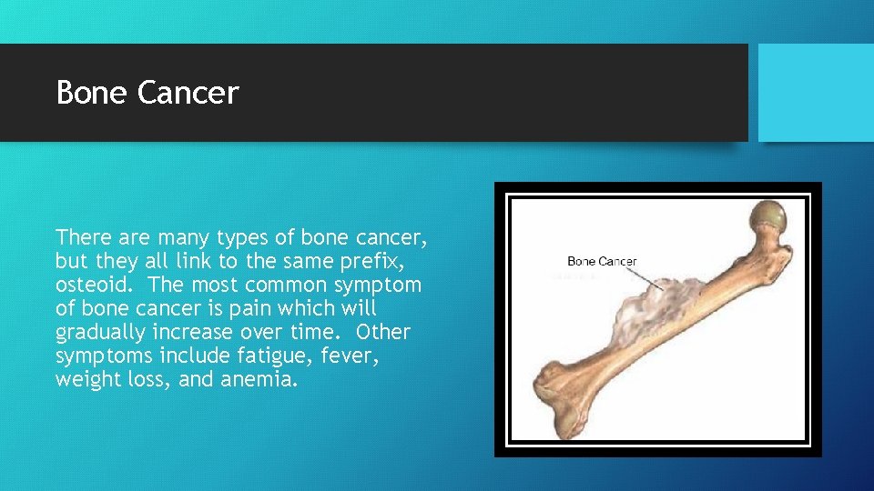 The Skeletal System By Daniel M Aidan Kelvin