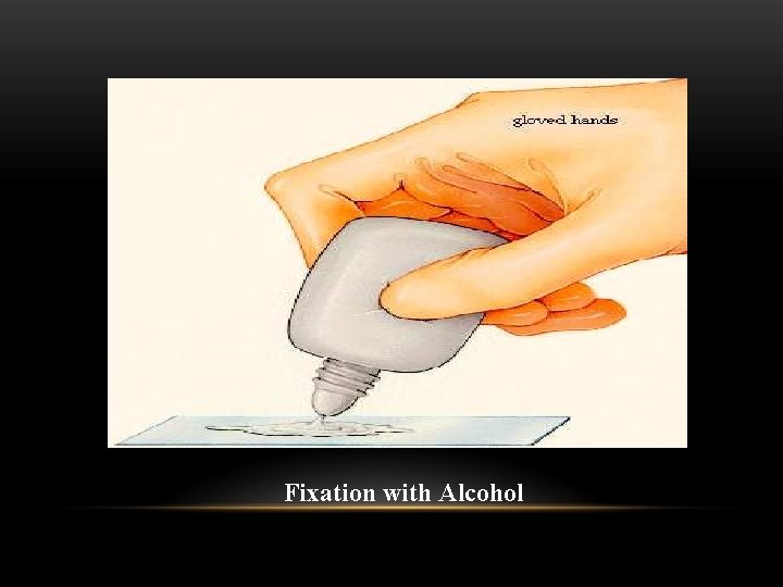 SCREENING FOR FEMALE GENITAL TRACT MALIGNANCY BY Dr