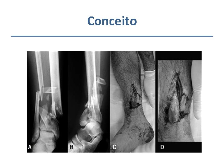 Fratura Exposta Rodrigo Salim Conceito Sempre perceptvel visvel