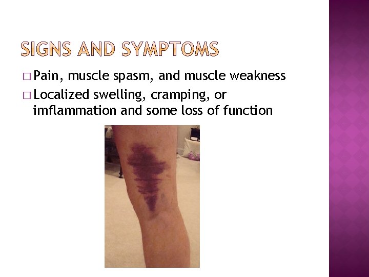 Bones and Soft Tissues Aids in body movement