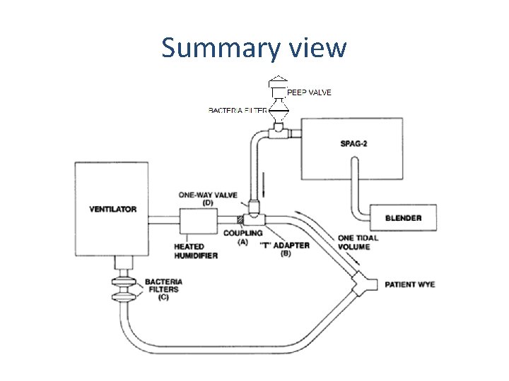 SPAG Delivery through the Ventilator David R Gibson